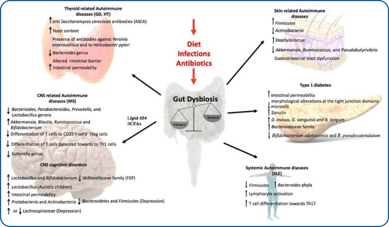 Intestinal Microbiota Influences Non-intestinal Related Autoimmune Diseases